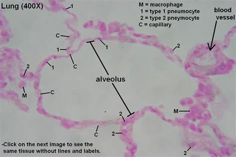 D Lung Alveoli 400X 1