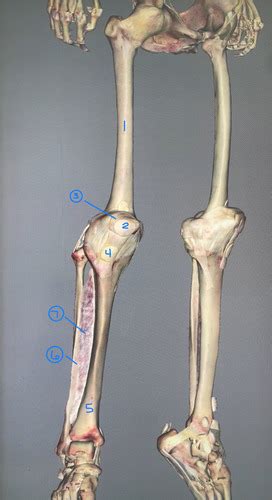 Lower Extremity Lab Bones Flashcards Quizlet