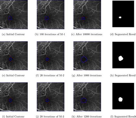 figure 7 from a coeﬃcient of variation based image selective segmentation model using active