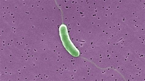 Qué se sabe de la bacteria come carne y cómo puedes protegerte de su