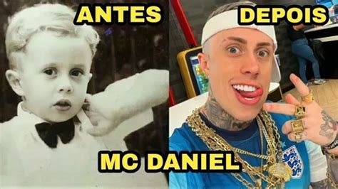 Antes E Depois De Mc Daniel