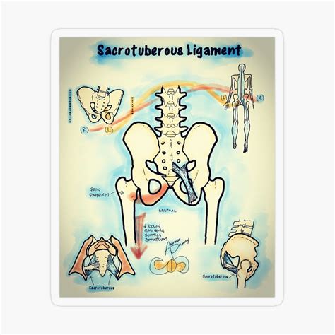 Sacrotuberous Ligament Pain