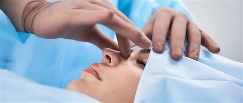 Tudo sobre Rinoplastia Cirurgias Faciais São Paulo