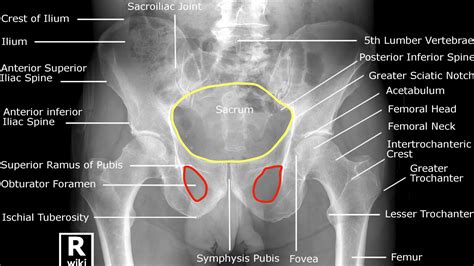 Normal Pelvic X Ray Women Telegraph