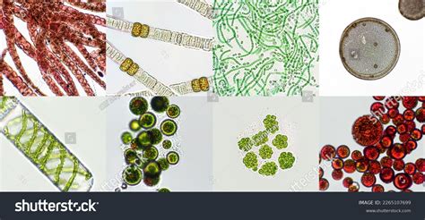 Microalgae Under Microscopic View Green Algae Stock Photo