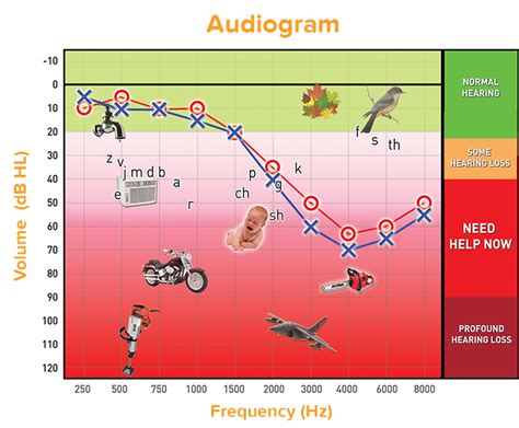 Normal Audiogram