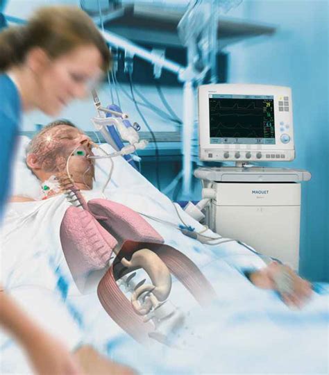 INTEC PRINCIPIOS BÁSICOS DE VENTILACIÓN MECÁNICA