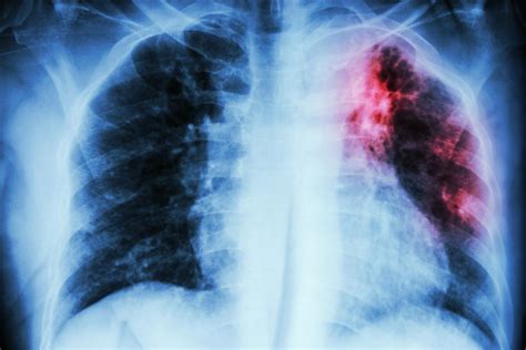 Les découvertes scientifiques qui ont marqué 2019
