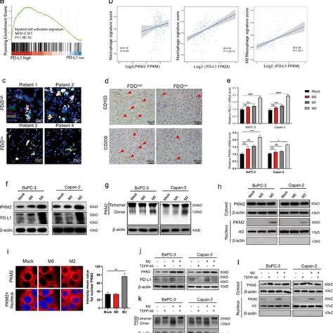 TGF β1 secreted by M2 macrophages promotes the nuclear translocation of