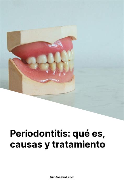 Periodontitis Qu Es Causas Y Tratamiento Ellabaloo