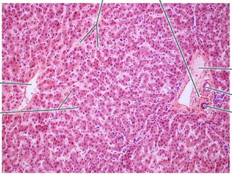 Hepatic Lobule Histology