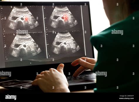 Ecografía del abdomen de una mujer en un monitor de pantalla portátil