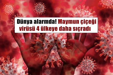 Maymun çiçeği virüsü 4 ülkeye daha sıçradı Turizm Avrupa