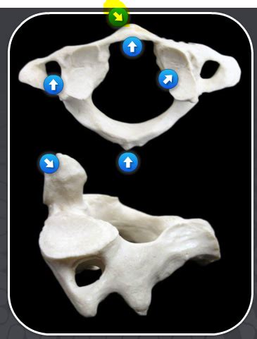 Skeletal System Lab Vertebrae Sternum Ribs Flashcards Quizlet