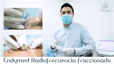 Endymed Radiofrecuencia Fraccionada Generaci N De Col Geno Cierre De
