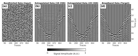 sensors free full text deep learning driven full waveform inversion for ultrasound breast