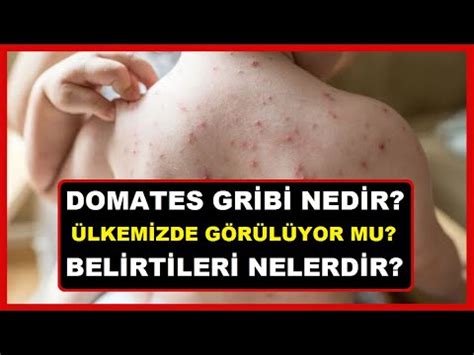 Domates Gribi Nedir Belirtileri Nelerdir Ülkemizde Görülüyor Mu