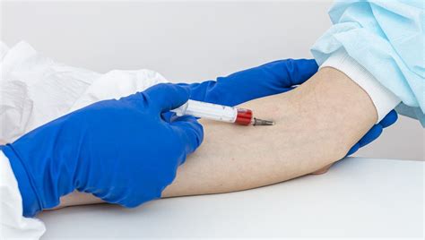Un análisis de sangre detecta el Li Fraumeni