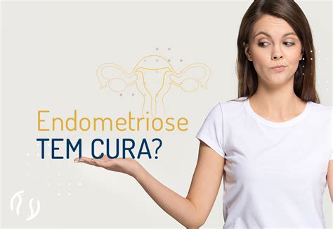 Endometriose tem cura Dr Luiz Flávio