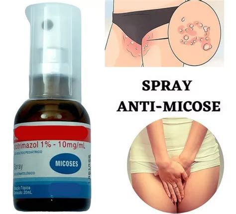 Micose Na Virilha Pomada Para Micose Na Virilha Spray G