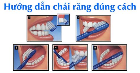 Hướng dẫn chải răng đúng cách Nha khoa và đời sống