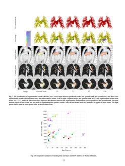 Efficient Automatic Segmentation For Multi Level Pulmonary Arteries