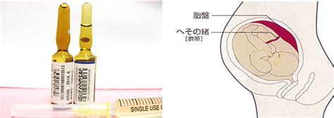 プラセンタとは