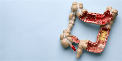 Best Ways To Cleanse And Detox Your Colon Healthnews