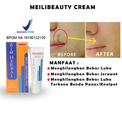 Jual Penghilang Bekas Luka Hitam Jerawat Koreng Dan Keloid Salep Krim
