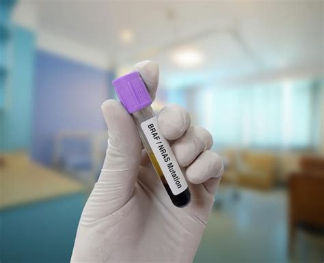 El científico tiene una muestra de sangre para la prueba de mutación