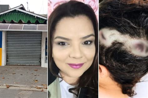 Mulher que sobreviveu após ser baleada na cabeça pelo ex fecha loja e