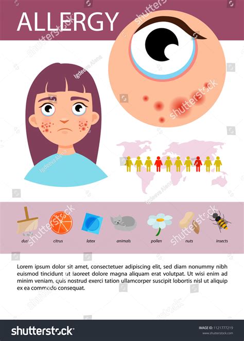 74 Atopic Dermatitis Infographic Images Stock Photos Vectors