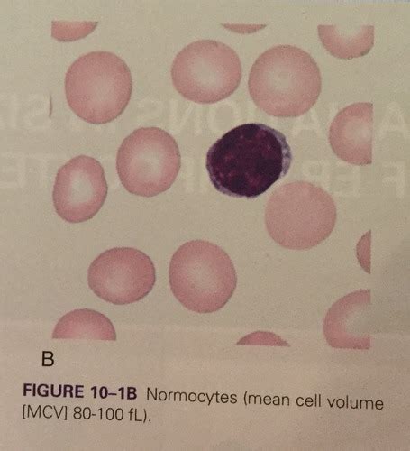 Rbc Morphology Flashcards Quizlet