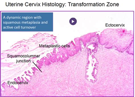 Endocervix Histology