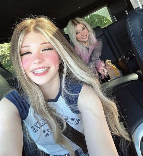 Spring Aesthetic Aesthetic Hair Braces Girls Internet Girl Girl
