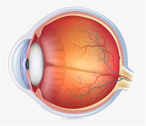 Desprendimiento de Retina Causas síntomas y tratamiento Urgencias