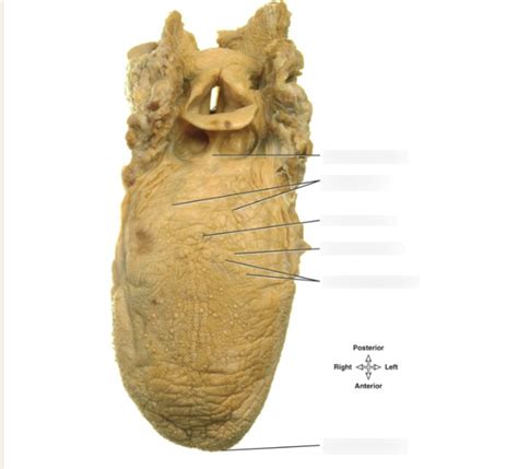 Ch Lingual Tonsil Diagram Diagram Quizlet