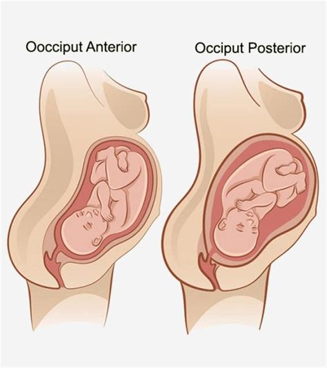 Fetal Position Presentation Guide To Expecting Mothers