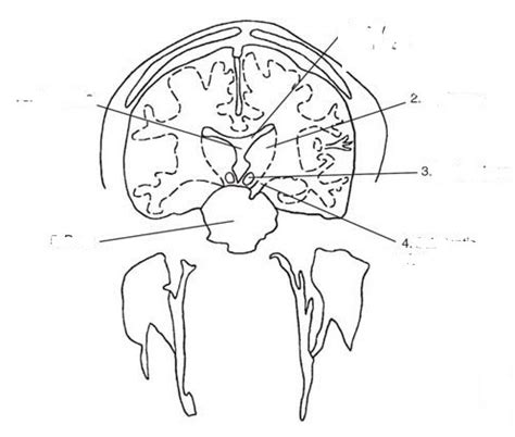 Coronal MRI Head Slice 9 Diagram Quizlet