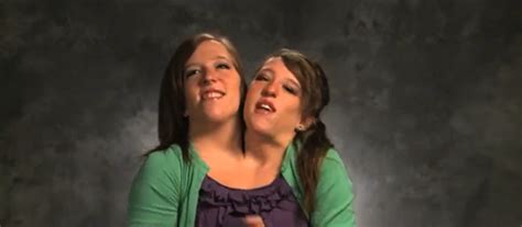 Conjoined Twins Abby And Brittany Married 2022