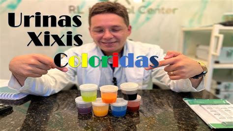 Cores da urina coloração do xixi o que devemos saber sobre a cor da