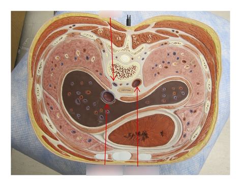 Abdominal Region Diagram Quizlet