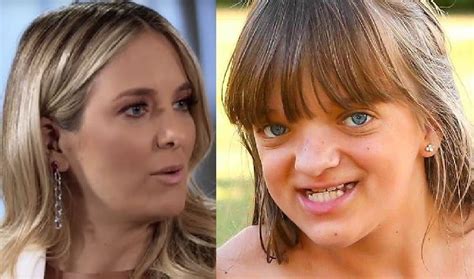 Rafaella Justus arranca elogio após procedimento na face e mostra antes