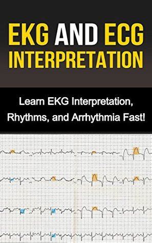 Ekg And Ecg Interpretation Learn Ekg Interpretation Rhythms And