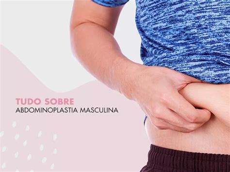 Abdominoplastia Masculina Antes E Depois Valor Cicatriz E Tudo O Que