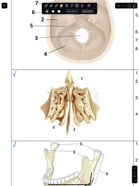 Ethmoid Bone Diagram Quizlet