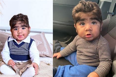 Bebê que nasceu barba faz sucesso nas redes sociais e pai explica