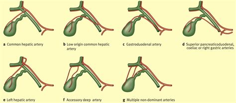 Anatomy Of The Gallbladder And Bile Ducts Surgery Oxford