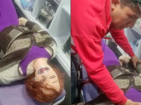 Watch Man Has Medics Treat His Sick Rag Doll Wife