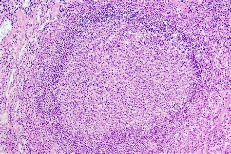 Normal Histology